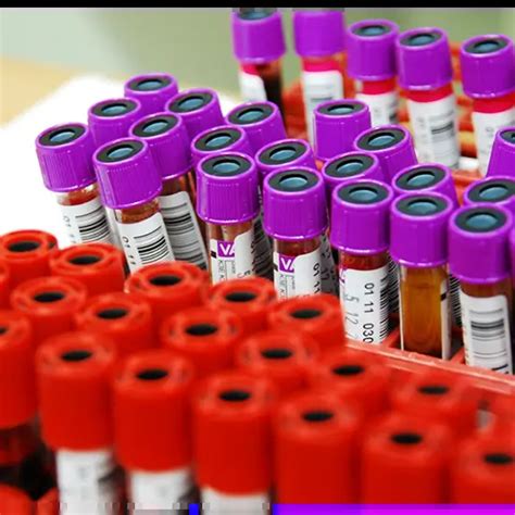 C2 Complement Component Test Near You In Delhi Book Test At Low Price