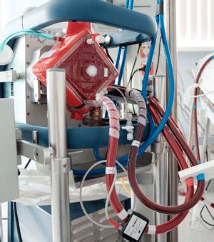 ECMO Support For SAIL Facilities Tathya