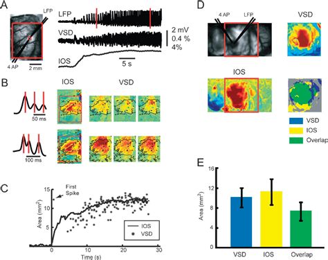 Figure 8 From Dynamic Neurovascular Coupling And Uncoupling During Ictal Onset Propagation And
