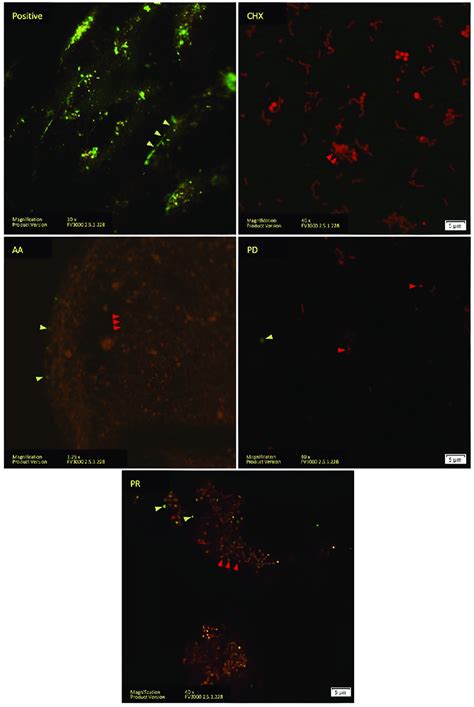 Live Dead Staining Analyzed With Confocal Microscope Of Vivera ® Download Scientific Diagram