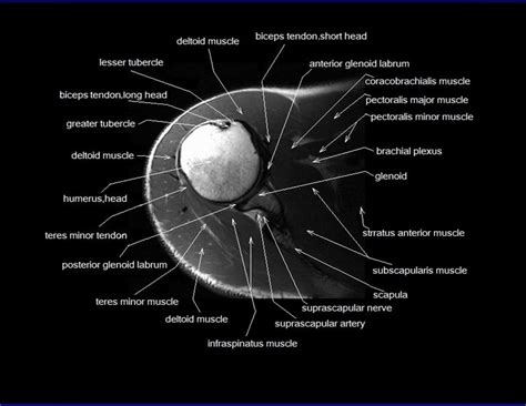 Shoulder Anatomy Mri Shoulder Axial Anatomy Free Cross Sectional