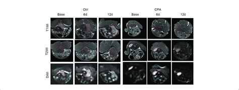 Conventional Mri T1 And T2 Weighted Images And Functional Maps Of