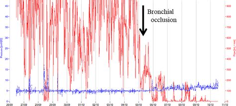 This Chart Shows The Decrease In Air Leakage And The Level Of Suction Download Scientific