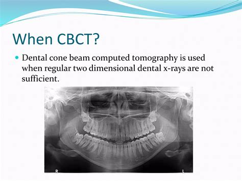 Cbct Pptx Dental Health Diseases And Conditions
