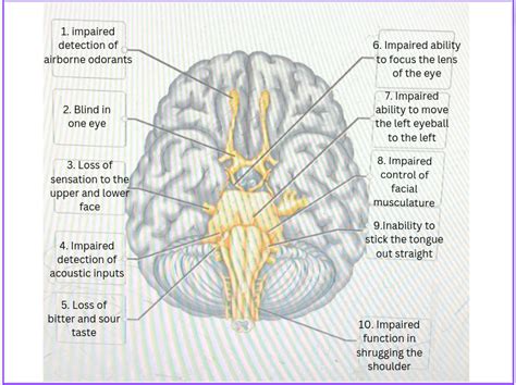 Solved I Ne Labels Describe Signs And Symptoms Of Cranial Nerve
