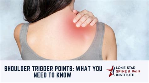 Shoulder Trigger Points What You Need To Know Shoulder Trigger Points What You Need To Know