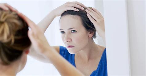 Losing Hair Losing Self Esteem Find Hope And Solutions