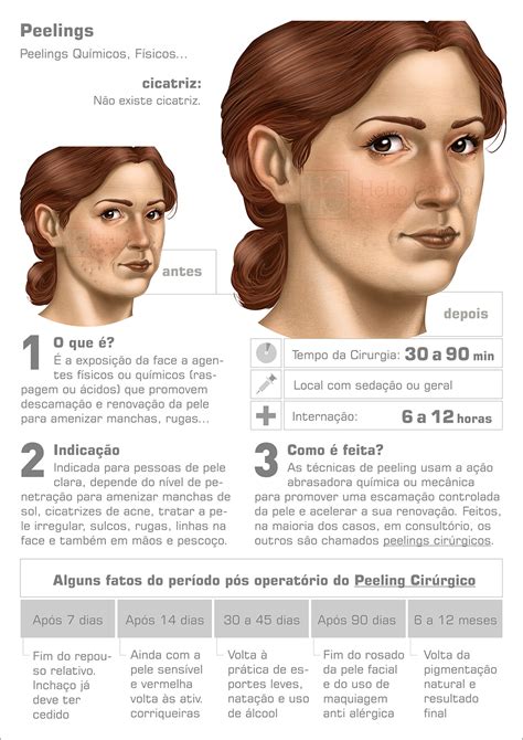Peeling Químico Dr Helio Caprio Cirurgia Plástica Cirurgião