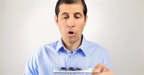 Androgenetic Alopecia Treatment How To Stop Hair Loss
