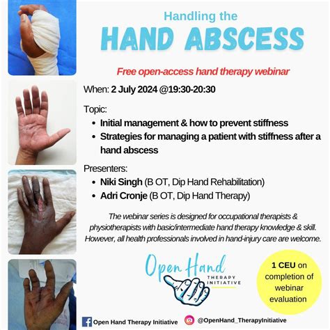 Handling Hand Abscess Niki Singh