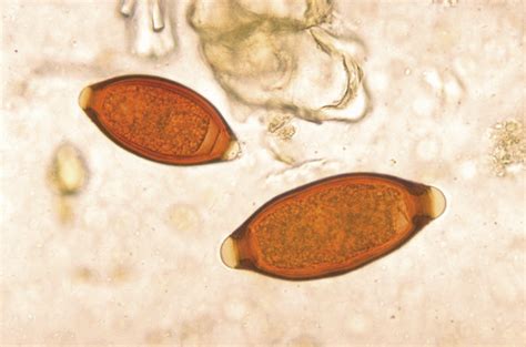 Platelmintos E Nematelmintos Os Vermes Caem Nas Questões De Biologia Enem