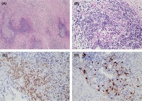 Low Power Field Hande Staining Revealed A Fibroconnective Tissue