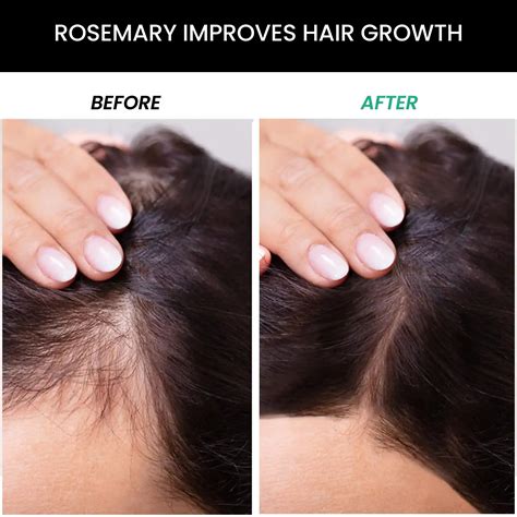 Thriveco Rosemary Hair Kit With Shampoo Conditioner And Eo