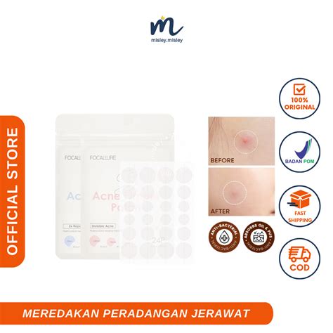 Jual Misley Focallure Spot Patch Acne Treatment Day Night Original