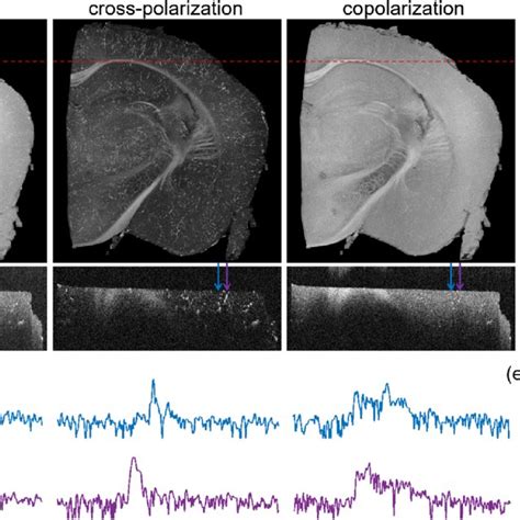 PS OCT Contrasts Of A Mouse Brain With TiO 2 Particles In The Download Scientific Diagram
