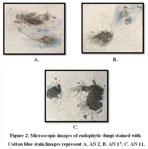 Diversity And Molecular Characterization Of Endophytic Fungi Associated