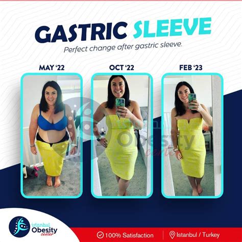 Gastric Sleeve Before And After Istanbul Obesity Center
