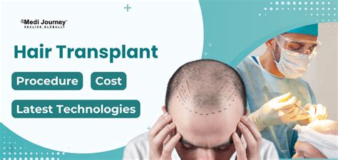 Hair Transplants Procedure Latest Technologies And Success Rate