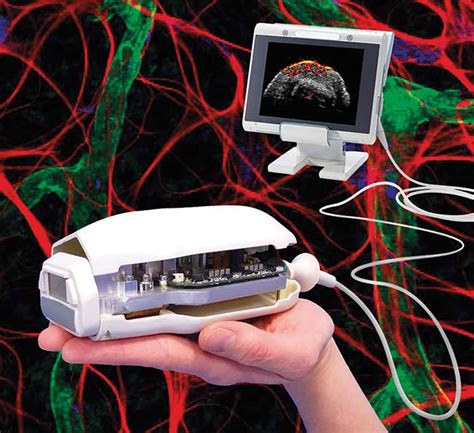 Pulsed Laser Diodes Can Hasten Clinical Use Of Photoacoustic Imaging Features Sep