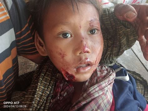 မောင်တောမာ စစ်ကောင်စီပစ်ထားရေ လက်နက်ကြီးကျည်ကို အချေတိ ဝိုင်းထုရာက အချေ