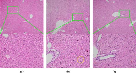 Morphology Of The Liver Tissue Of The Blank Group A Model Group B Download High