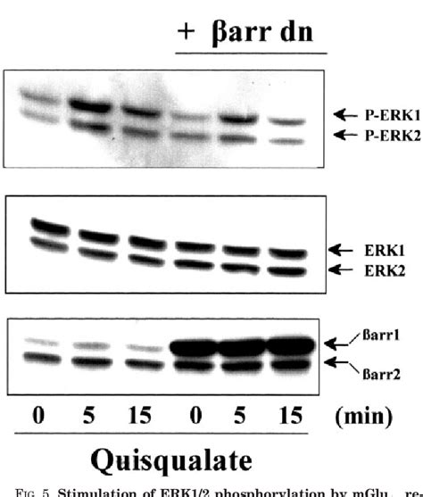 Figure 5 From Role Of G Protein Coupled Receptor Kinase 4 And β