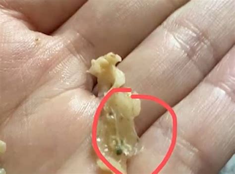 女子称网购蒸饺吃出指甲盖大的玻璃，商家：扔掉蒸饺后退款，当事人：这是要我销毁证据赵女士新闻问题