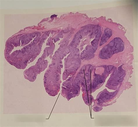Histology Of Palatine Tonsil Diagram Quizlet