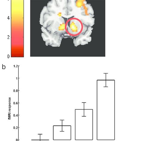 Reward Anticipation Related Activation In The Ventral Striatum As A Download Scientific Diagram