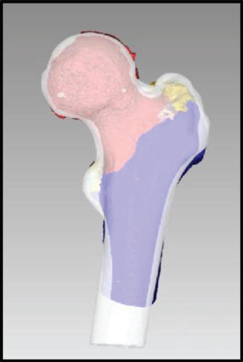 Reconstruction And Reduction A Volume Rendering B Surface