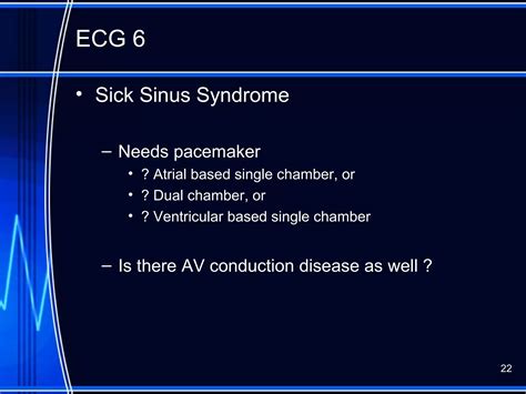 ecg approach to arrhythmias 2017 ppt