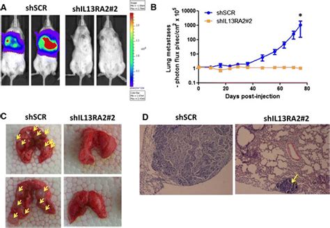 Targeting Il13rα2 Suppresses Breast Cancer Metastasis To The Lungs A