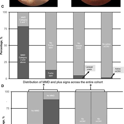 A And B Are The Representative Fundus Photograph Of A Myopic