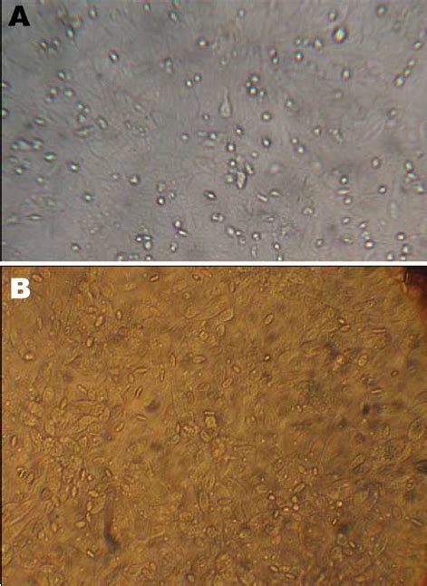 A Cytopathic Effect Of Lyophilized Newcastle Disease Virus Ndv