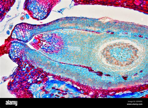 Pinus Ovulate Cone Labeled