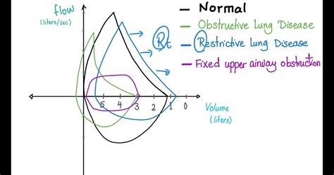 Restrictive Lung Disease Flow Volume Loop Quotes Home