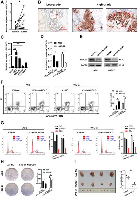 Identifying The Role Of NUDCD In Human Tumors From Clinical And Molecular Mechanisms A Study