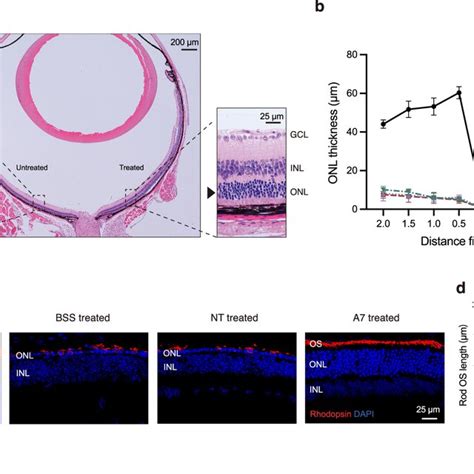Photoreceptor Preservation In Rd10 Mice After Abe Treatment A