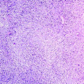 Histological Finding With Hematoxylin And Eosin Staining At Original