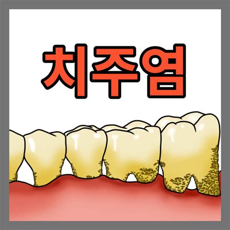 치주염 증상과 원인 및 치료치주 질환 치은염