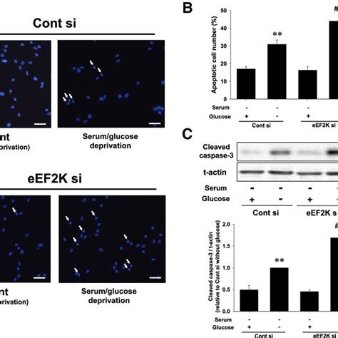 Eef2keef2 Axis Under Gd Condition Regulates The Signals Related To