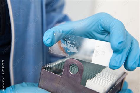 Scientist Placing Slides With Paraffin Embedded Tissue Samples Into A Slide Staining Rack