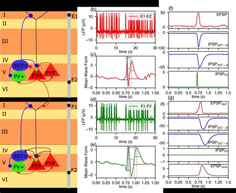 A Minimal Network Of The Epileptogenic Zone Ez And Non Epileptogenic