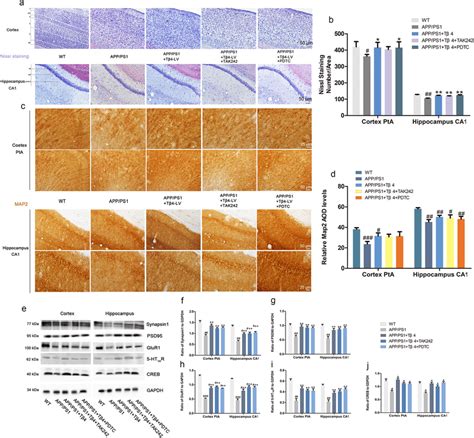 The effects of Tβ4 intervention and inflammatory pathway inhibition on Download Scientific