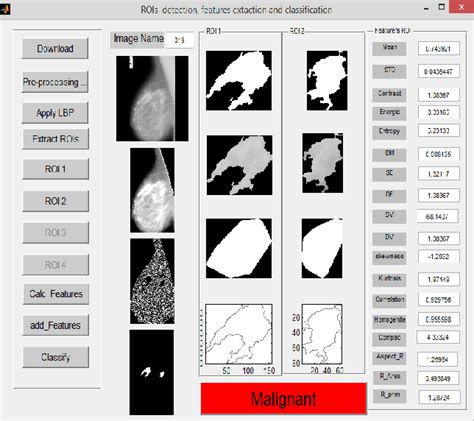 Figure 1 From Automatic Diagnosis And Classification Of Abnormalities In Digital X Ray