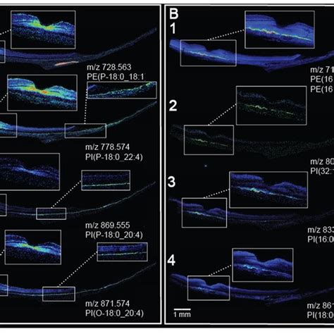 Maldi Ims Shows Complementarity Of Signals In Retina And Rpe A Download Scientific Diagram