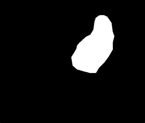 examples taken from the development part of the polyp segmentation download scientific diagram