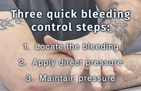 Lucho Cpr On Linkedin A Bleeding Injury Can Happen Anywhere At Any