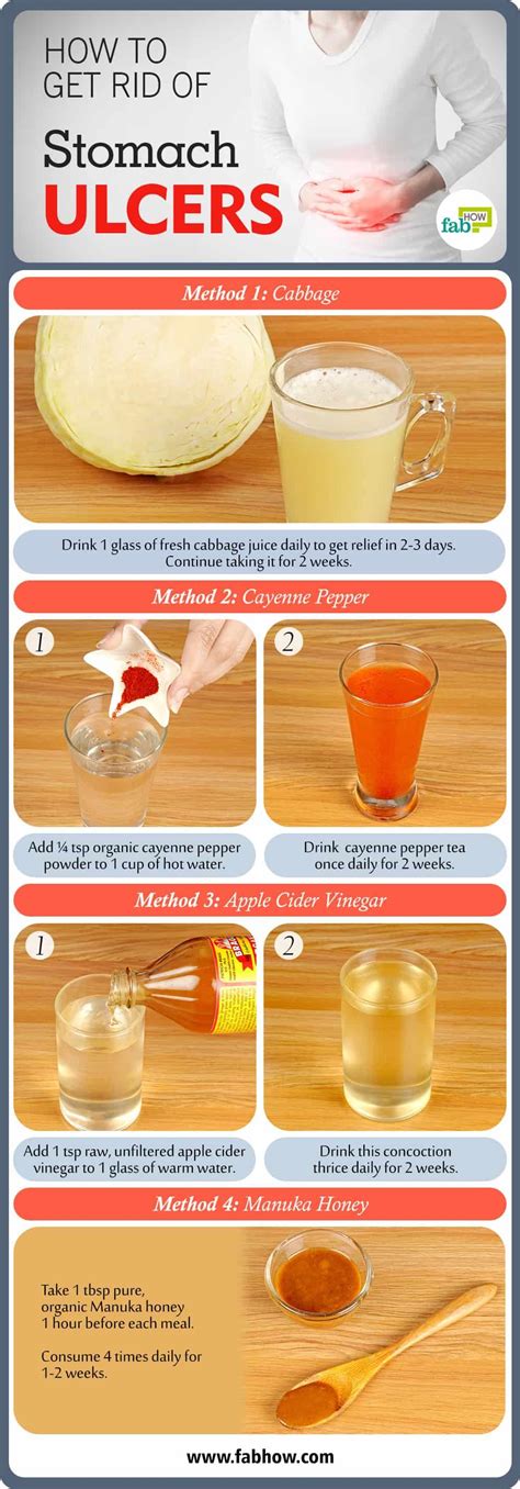 Beautiful Work Info About How To Heal An Ulcer Naturally Waterask