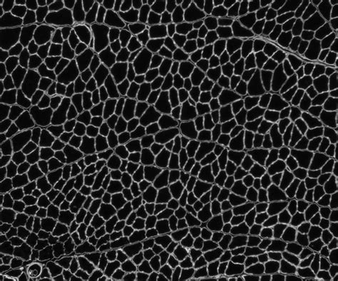 Truefad True Fiber Atrophy Distinction Myotube And Muscle Fiber